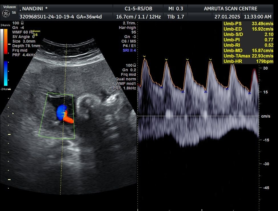 Important Check Scans: AFI, FHR, Cervical Status & Doppler